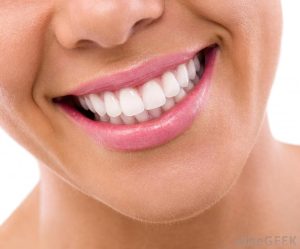 Baton Rouge - Exceptional Dental